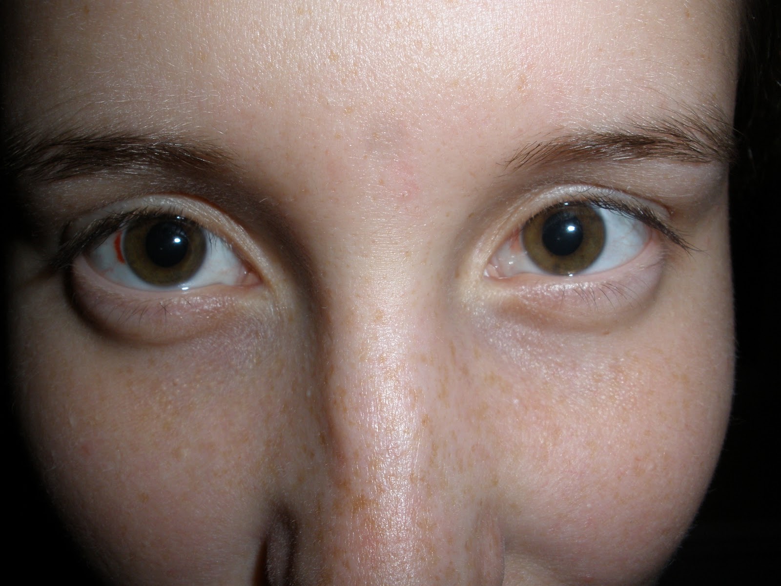 thestephzii: Laser ogen