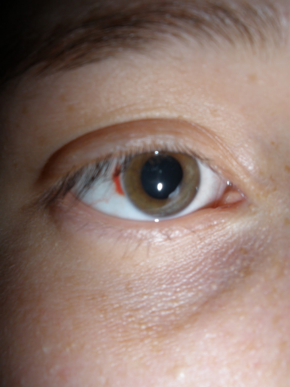 thestephzii: Laser ogen