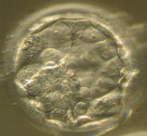 Bright Nepenthe: Stem Cells, Part 1