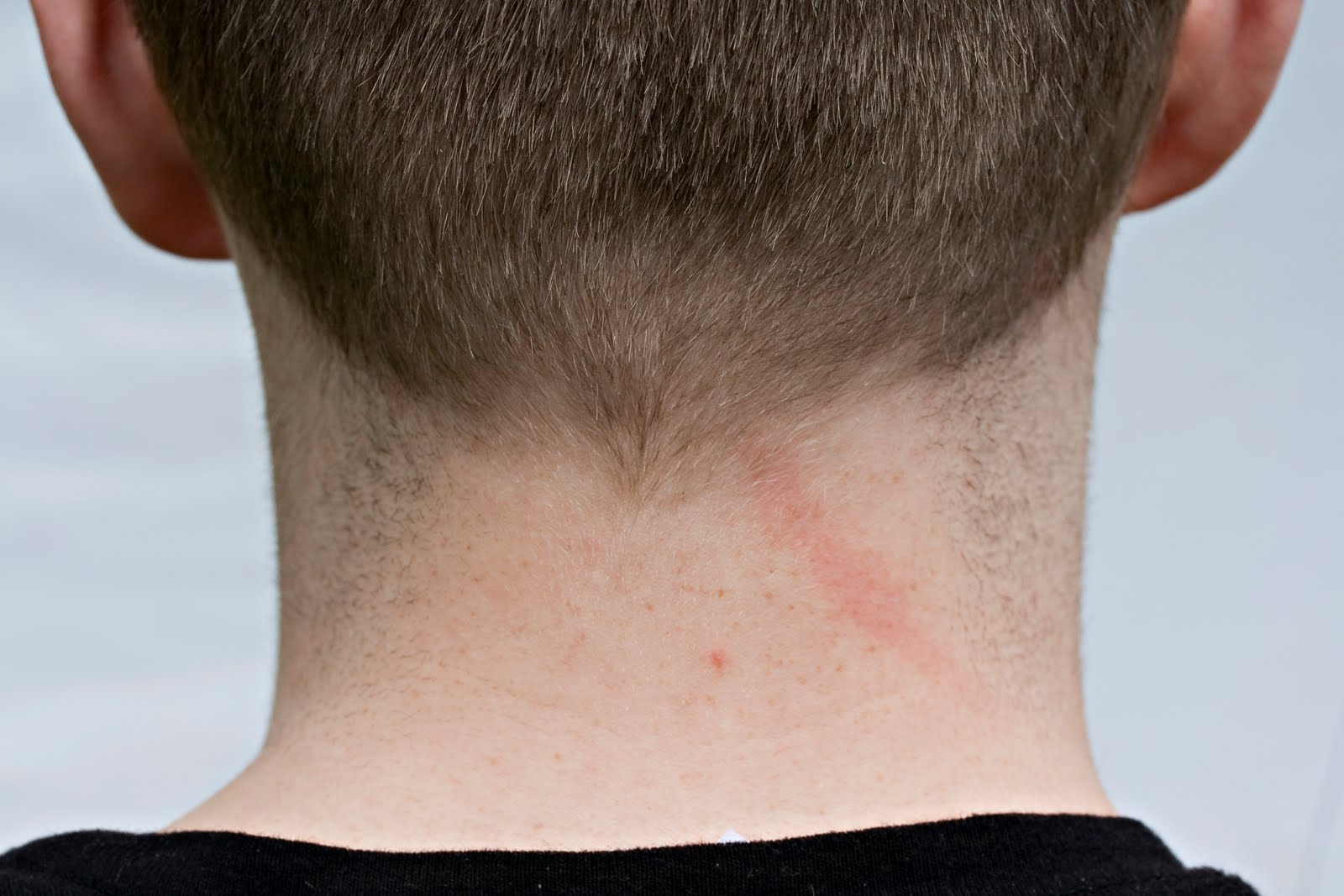 Peter Marley | Paradox Pictures Photography: Somebody [Part V]: Nape