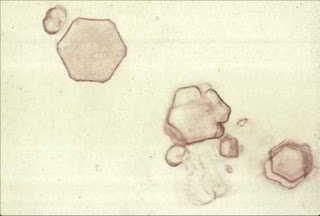 Junaid Mohamed: Microscopic Examination Of Urine