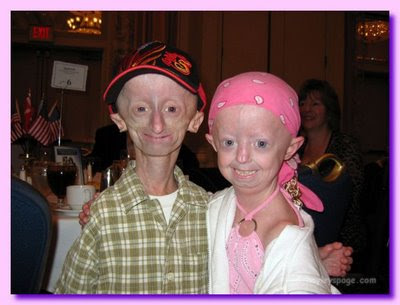 Una Ventana al Mundo: Progeria, síndrome de envejecimiento prematuro