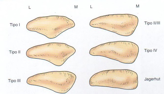 11:50: TIPOS DE ROTULA