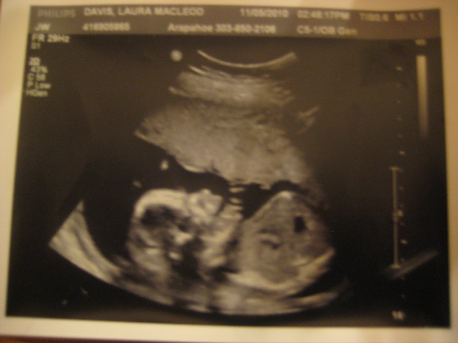 The Davis Family: 21 weeks and an Ultrasound!
