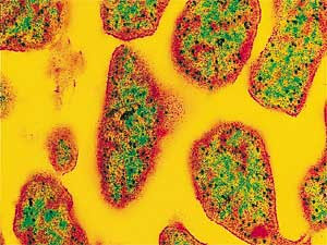 Extremophiles, Microbes, and the Frozen Desert: Extremophiles: