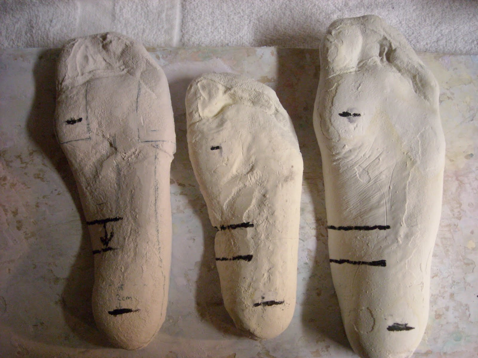 Foot and Ankle Problems By Dr. Richard Blake: Inverted Orthotic ...