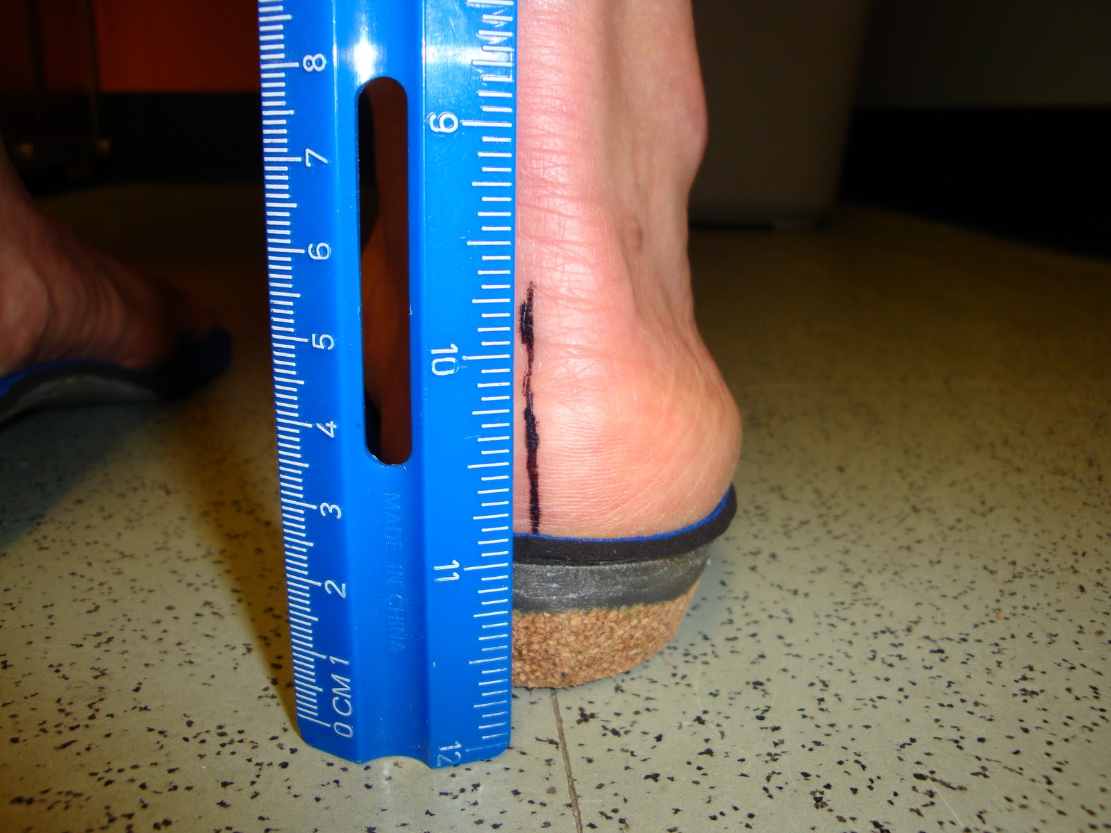 Foot and Ankle Problems By Dr. Richard Blake: Posterior Tibial ...
