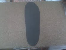 Foot and Ankle Problems By Dr. Richard Blake: Short Leg Syndrome ...