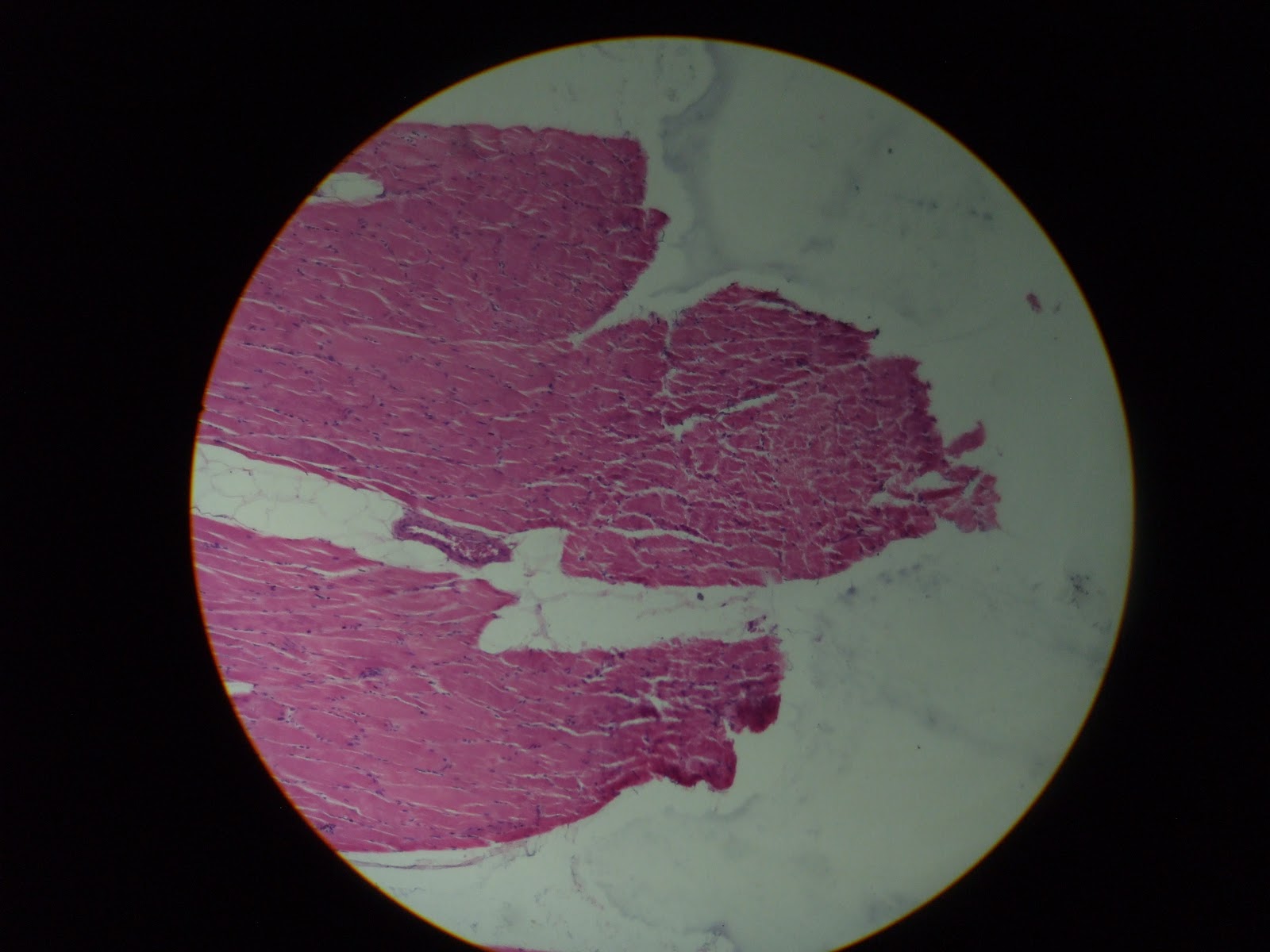 Histologia en Laboratorio: Tejido muscular