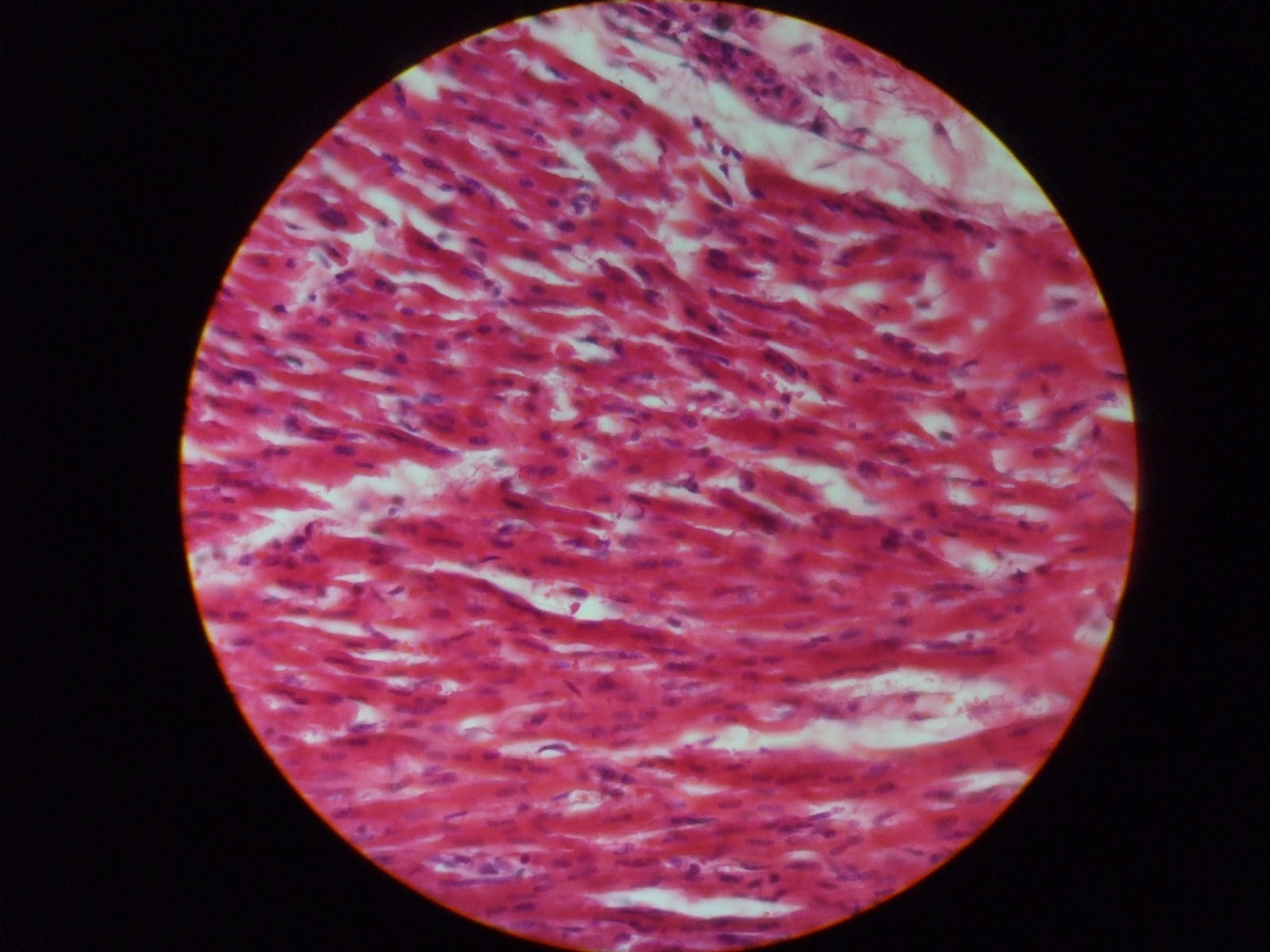 Histologia en Laboratorio: Tejido muscular