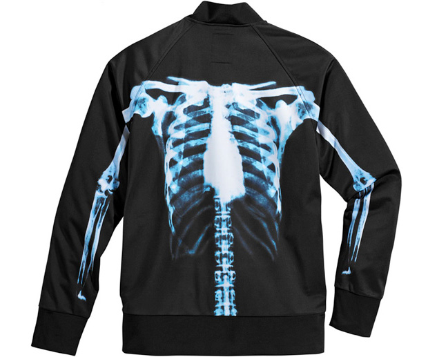 i - first person singular: X-Ray Track Suit | Jeremy Scott x adidas ...