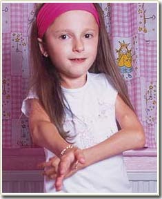 Fibrodysplasia Ossificans Progressiva: FOP Patient's Story