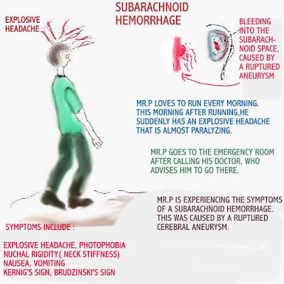 Dear Nurses: SUBARACHNOID HEMORRHAGE, A CASE STUDY