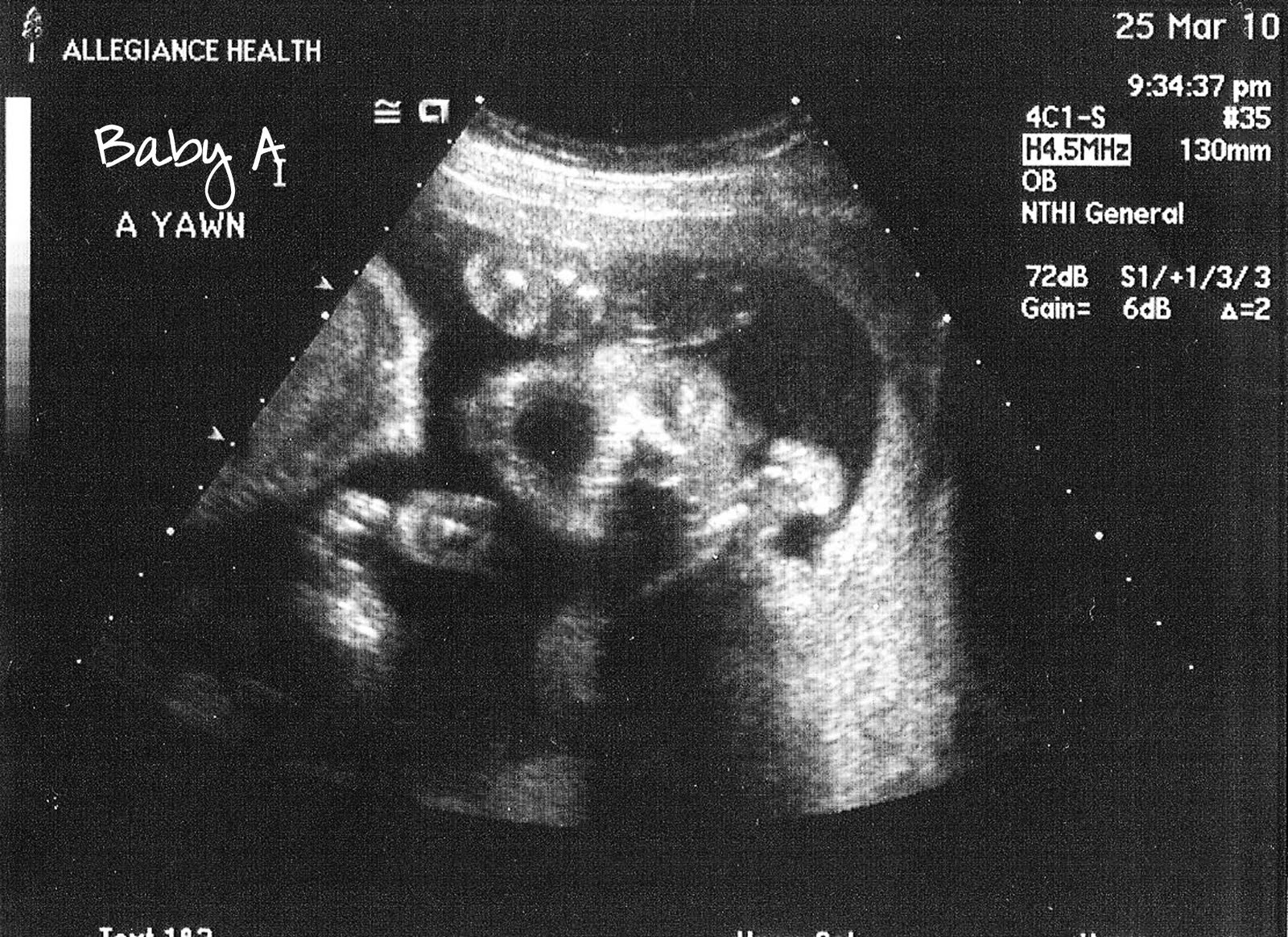 This Journey Called Life: Pregnancy: 24 Weeks