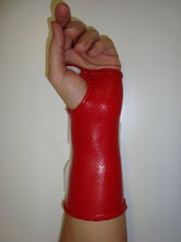 Orthèses sur mesure et appareillage personnalisé main poignet doigts ...