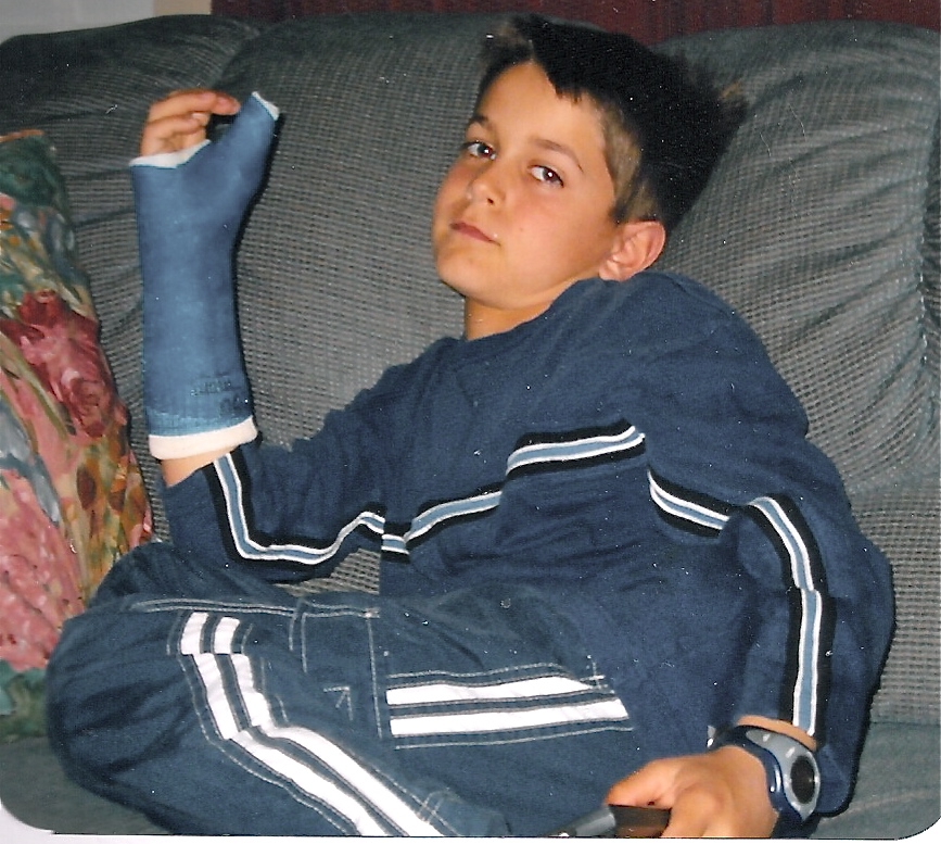 Raising a Son: Broken Bones