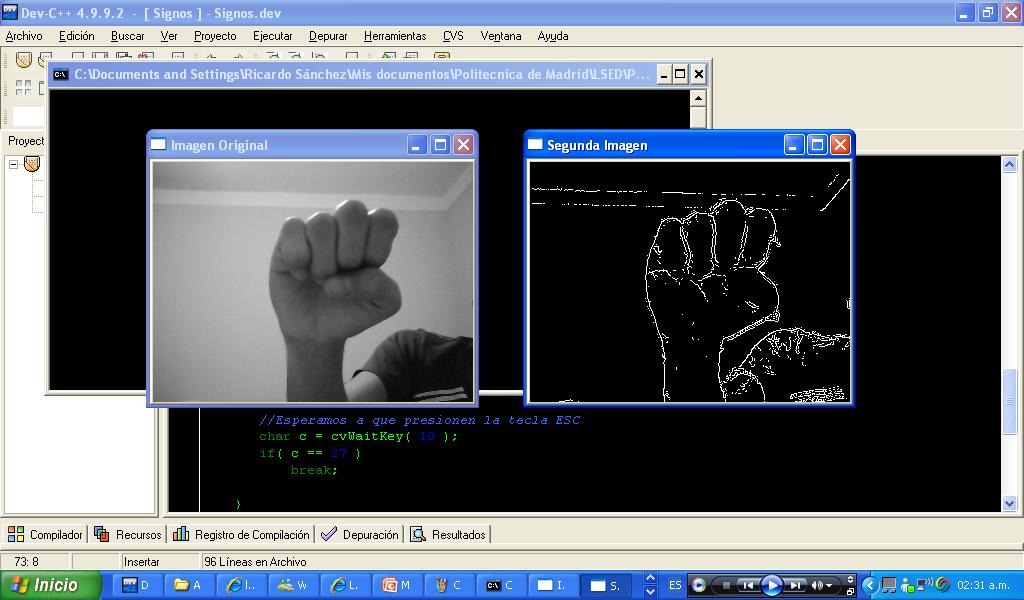 Lenguaje de signos: Realce de bordes y separación del fondo