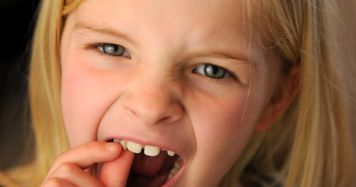 Singing and Spinning: Tooth #8 and how it happened...