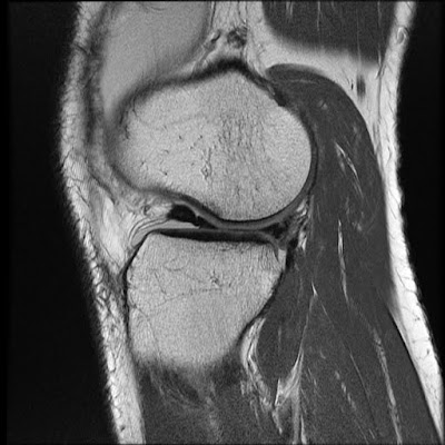 Radiology Cases: April 2010