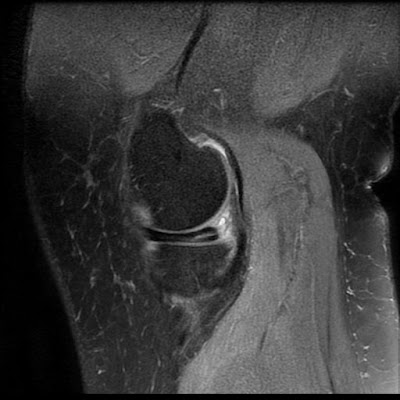 Radiology Cases: June 2009