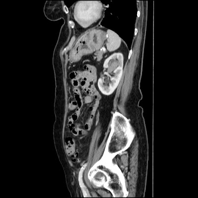 Radiology Cases: TCC