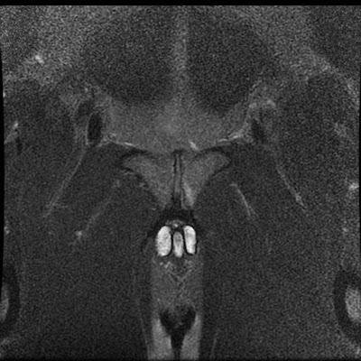 Radiology Cases: September 2009