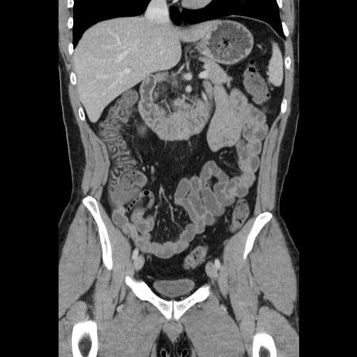 Radiology Cases: June 2010