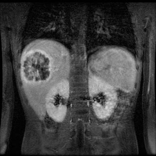 Radiology Cases: August 2010