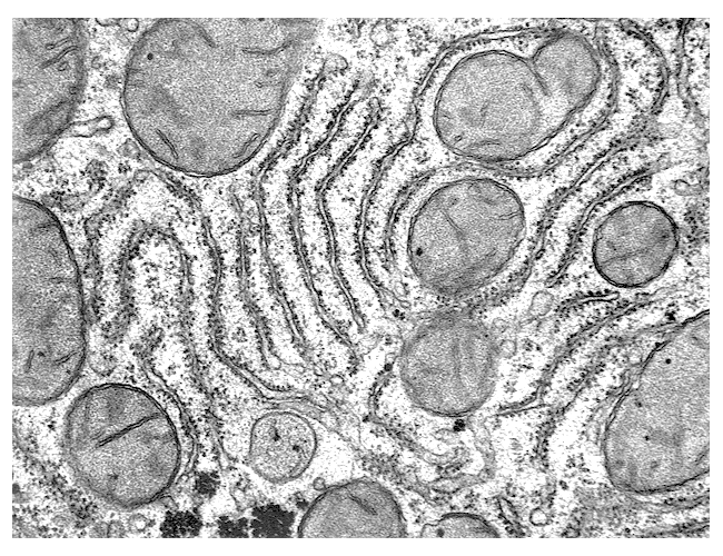 PATOLOGÍA: IX. MICROSCOPIA ELECTRÓNICA (ULTRAESTRUCTURA NORMAL)