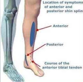 Leg Pain treatment guide : Lower leg pain