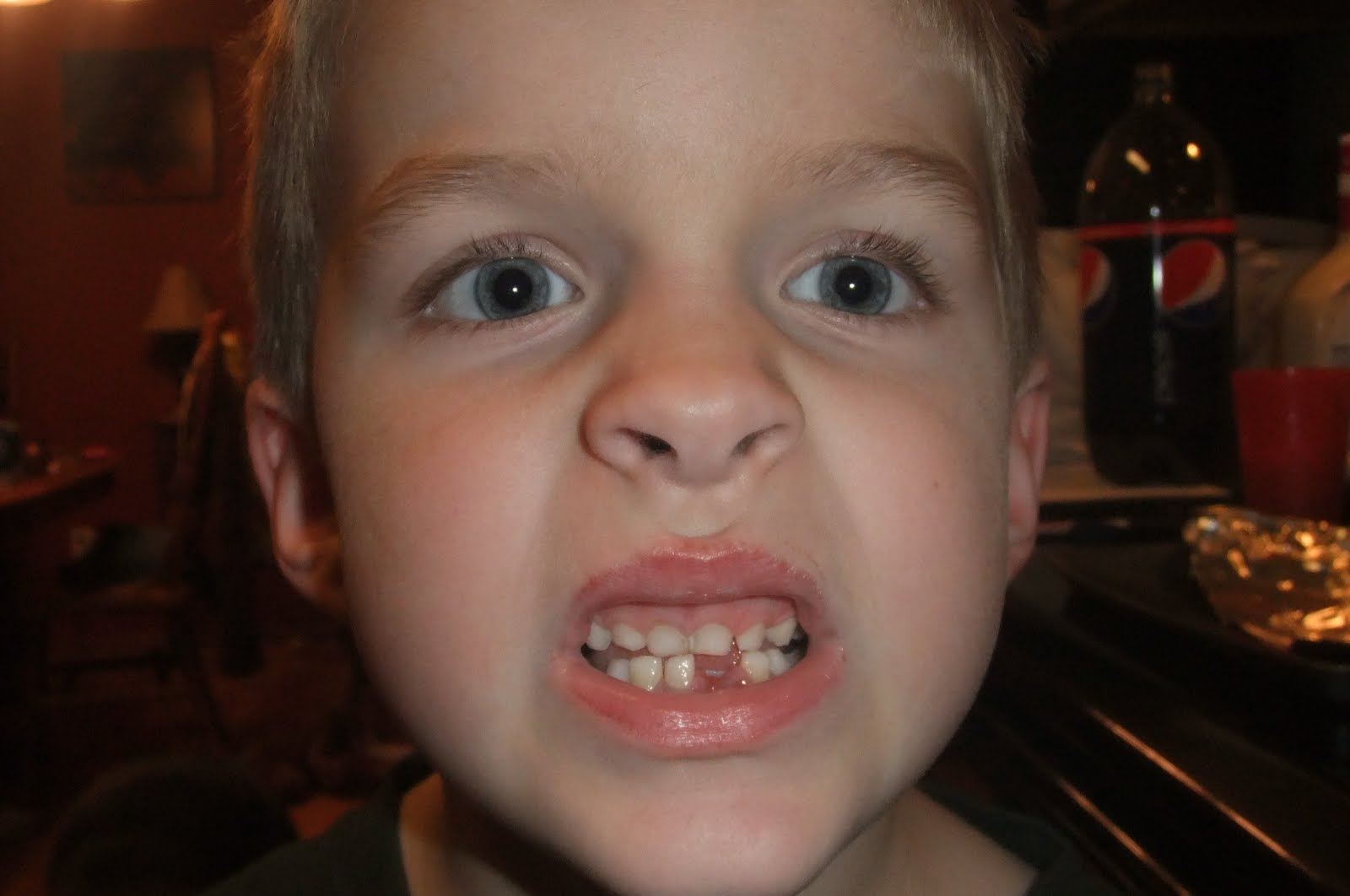 First lost tooth!