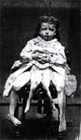 Destylou - Rarezas: Myrtle Corbin - Mujer con cuatro piernas