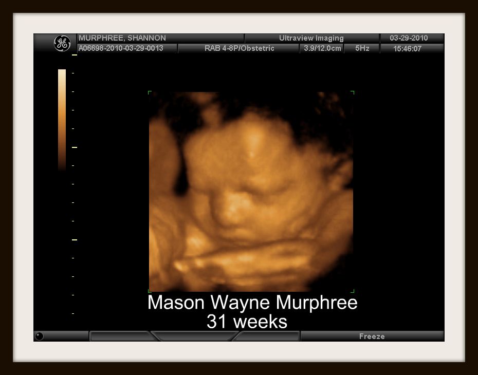 Just Me & My Boys: 3D Sonogram at 31 Weeks
