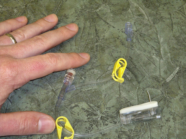 Marks Melon: 03/24/10 - Chemo Chest Port