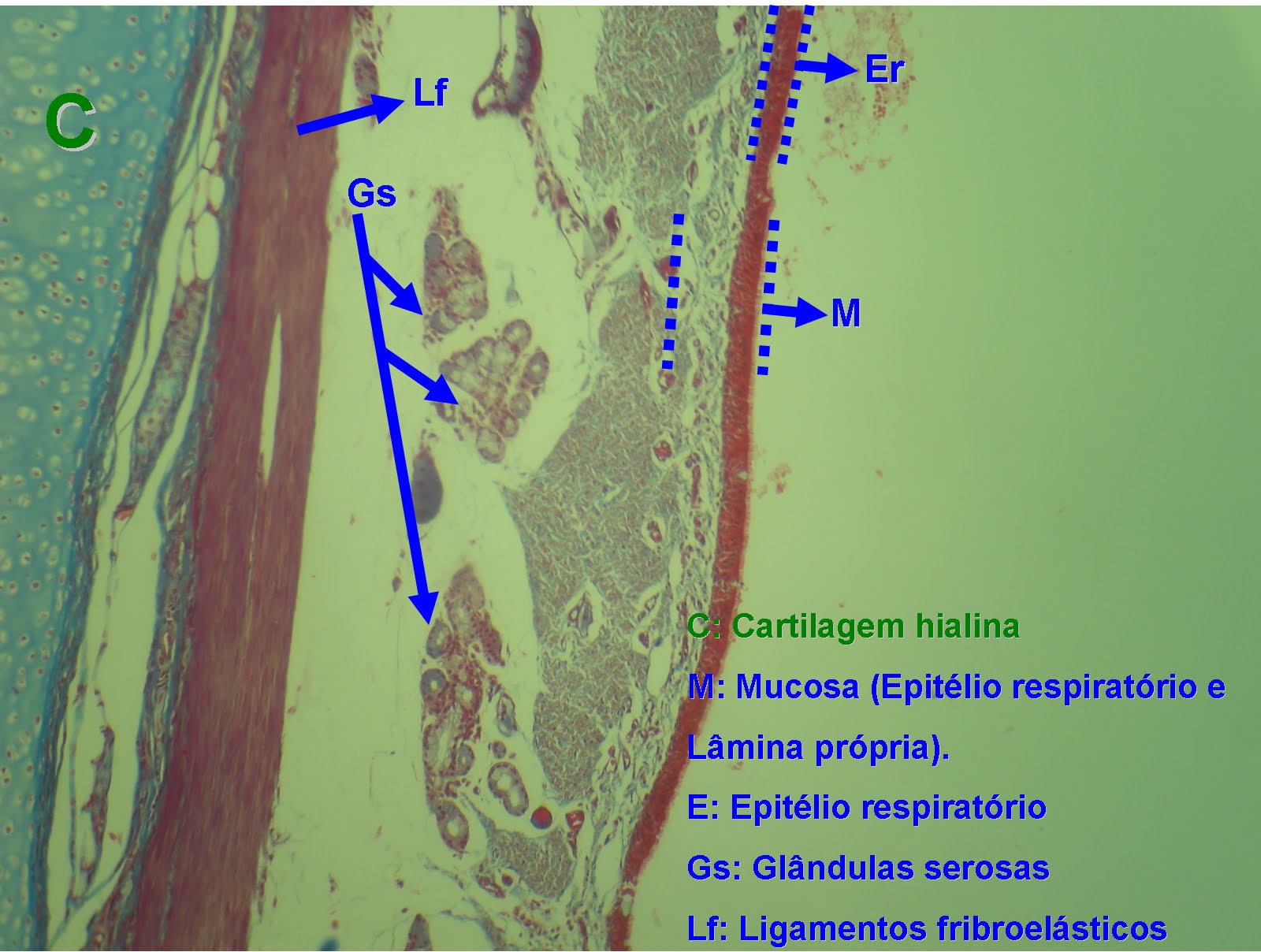 HISTOLOGIA-UFGD: (R4) CAMADAS DA TRAQUÉIA, (100X)