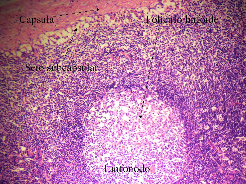 HISTOLOGIA-UFGD: (IM43) LINFONODO, (400X)