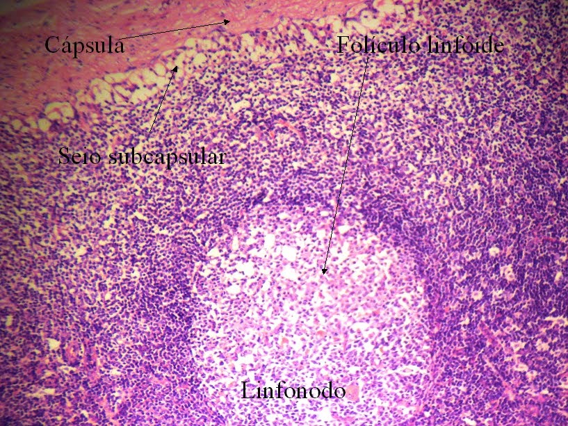 Histologia De Linfonodo Rotulada
