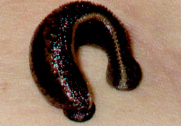 Terapi Bekam Lintah 010-508 9855 / 017 279 4353 Hana : Medicinal Leech ...