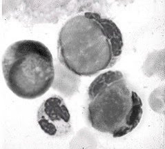 Laboratorium Kesehatan: Sel LE