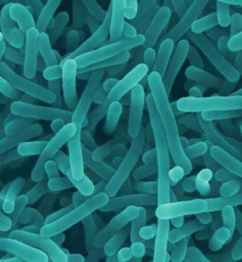 This14U: Gut bacteria firmicutes