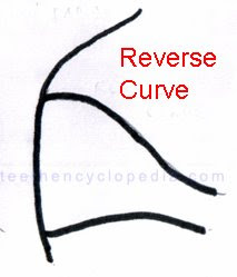 Dentist Connect: Steps in cavity preparation - Part 2 Resistence form