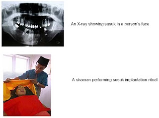 Between Science And Religion: Something about Susuk