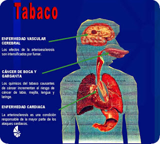 Tabaquismo: Mas informacion sobre el tabaquismo
