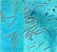 GOTAS MICROBIOLÓGICAS: ESTANDARIZACIÓN DEL INÓCULO POR DENSITOMETRIA ...