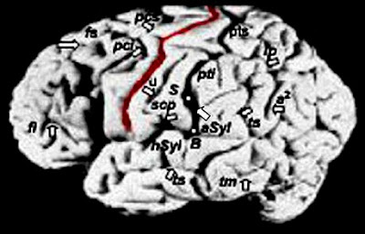 Talking Brains: Einstein's brain: anomalous auditory/language dorsal stream