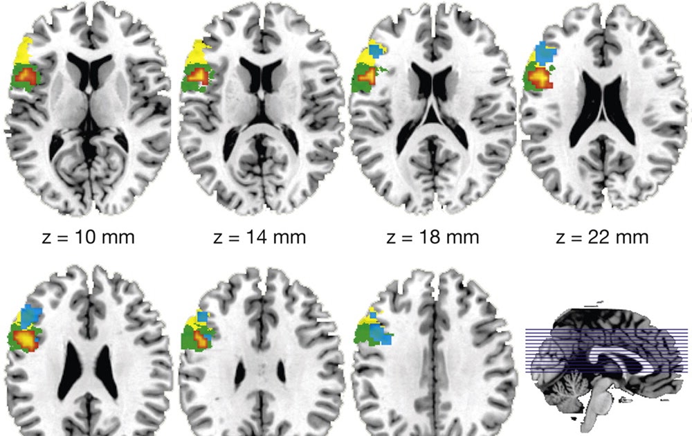 Talking Brains: Is Broca's area the site of the core computational ...
