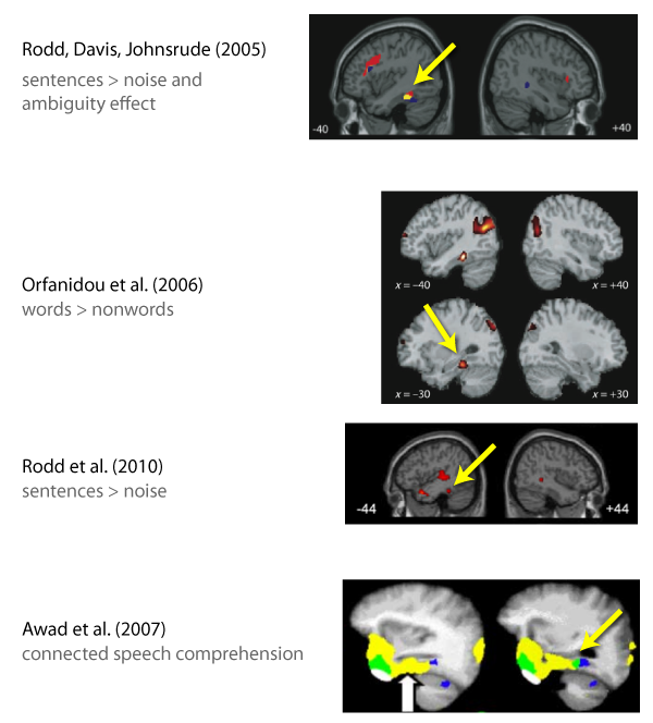 Talking Brains More On Intelligibility Guest Post From Jonathan Peelle