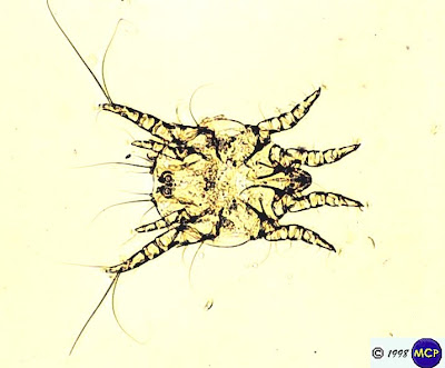 Veterinária on-line: Trombiculose - Trombicula autumnalis