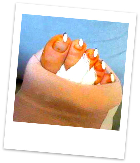 A Tale of Two Legs: Operation Feet