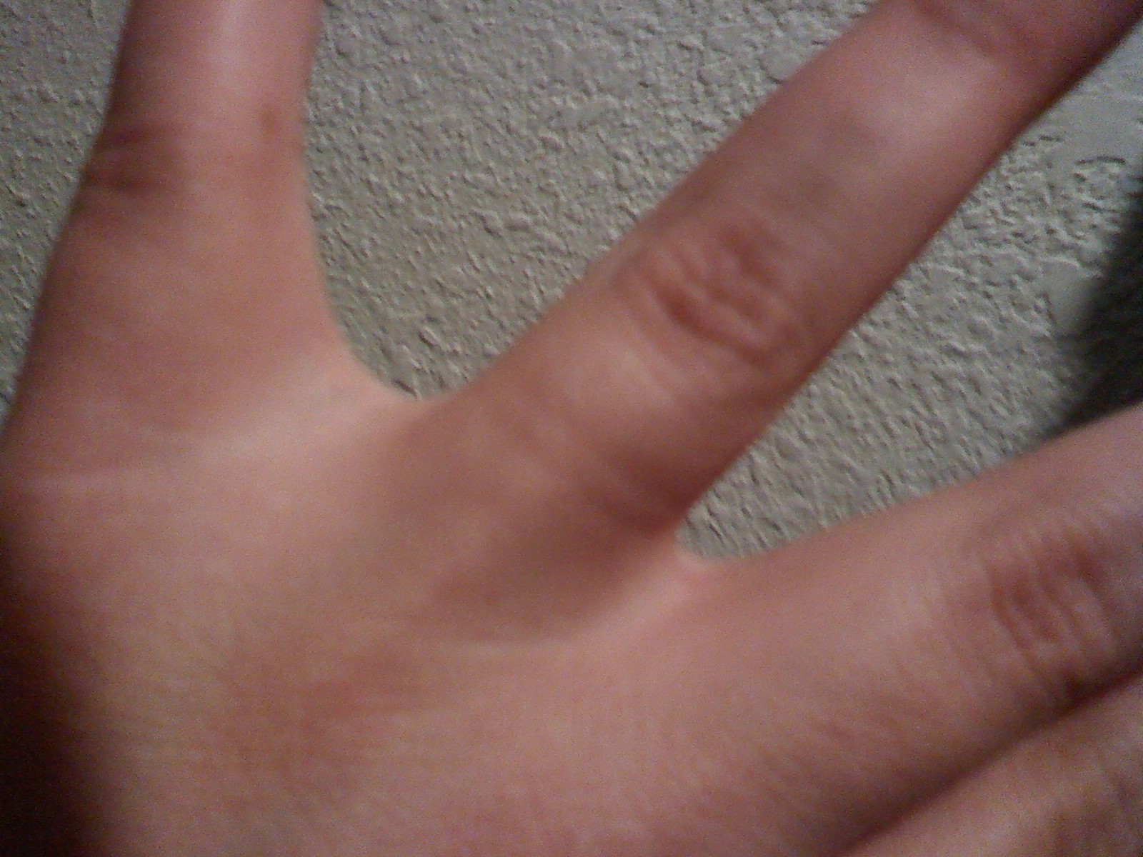 Open fields of wild flowers: The Wedding Ring Scar